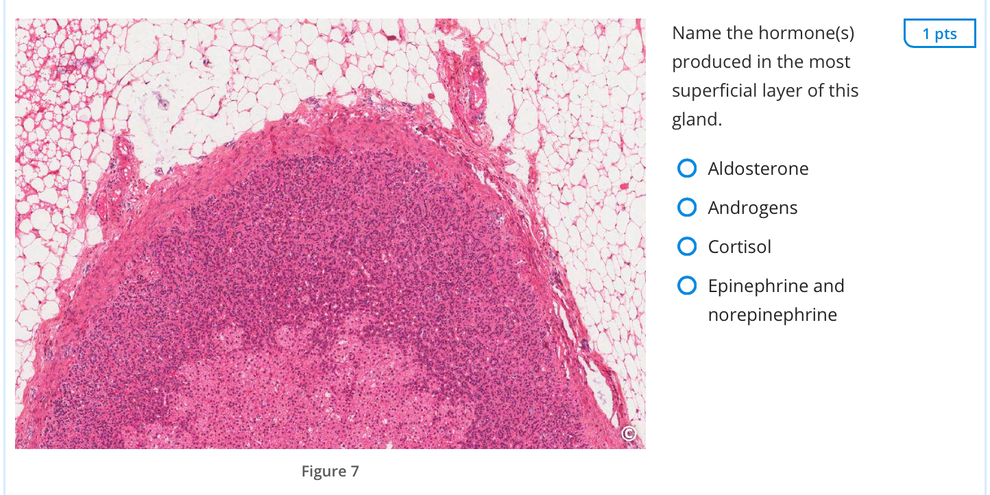 Solved 1 pts Identify the location of the endocrine tissue | Chegg.com