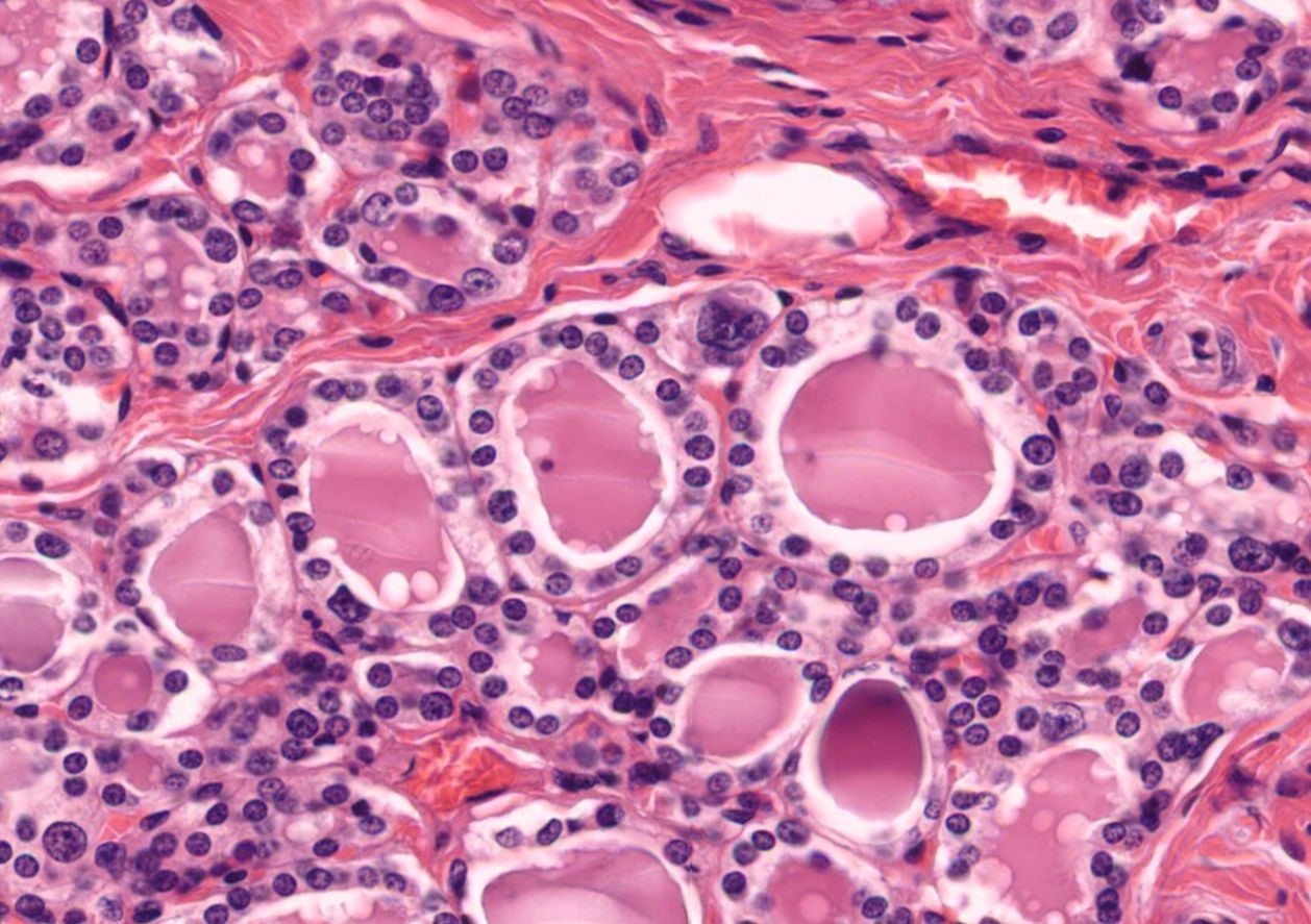 Solved Describe and Identify follicles, follicular cells, | Chegg.com