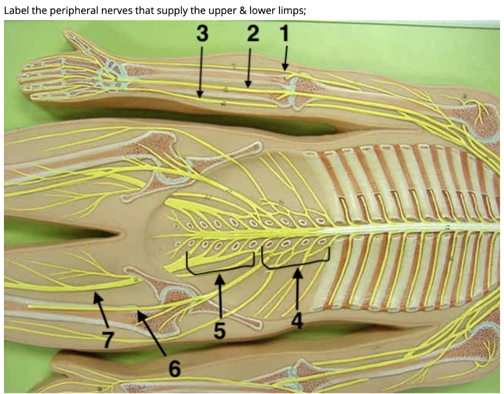 Solved Circulation of the CSF; label the pathway of the CSF | Chegg.com