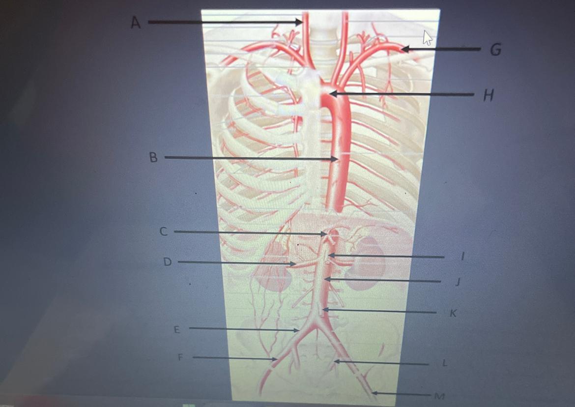Solved please label | Chegg.com