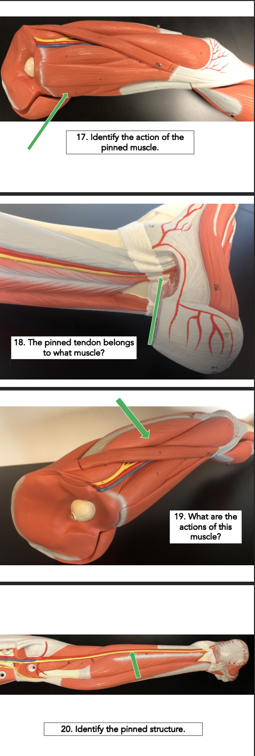 Solved 17. Identify the action of the pinned muscle. 18. The | Chegg.com