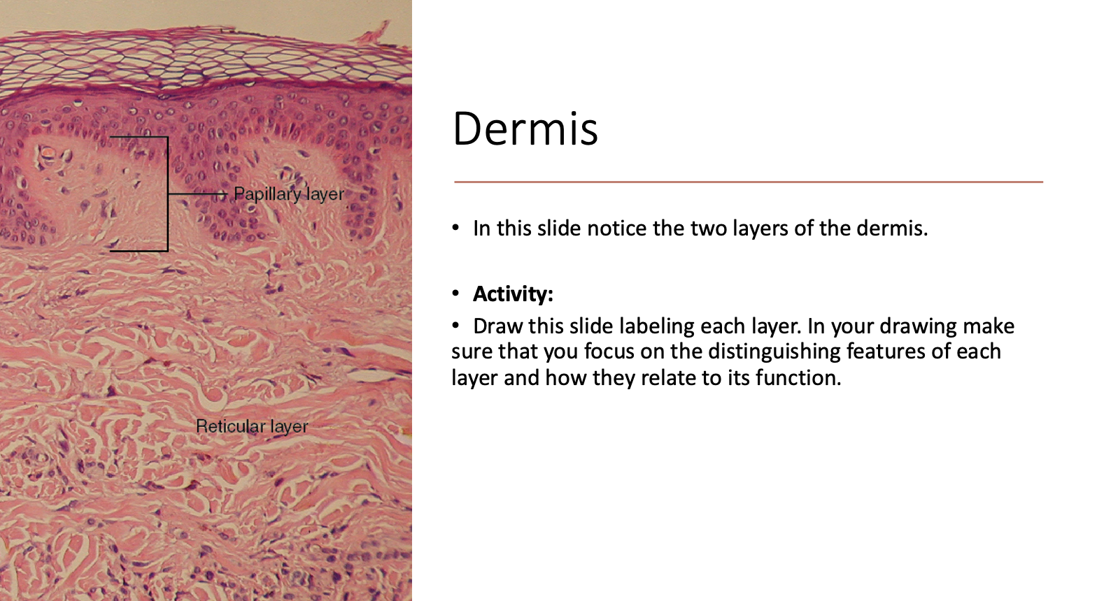 Solved Skin, thick H&E Skin epiderinis dermal papillae • In | Chegg.com