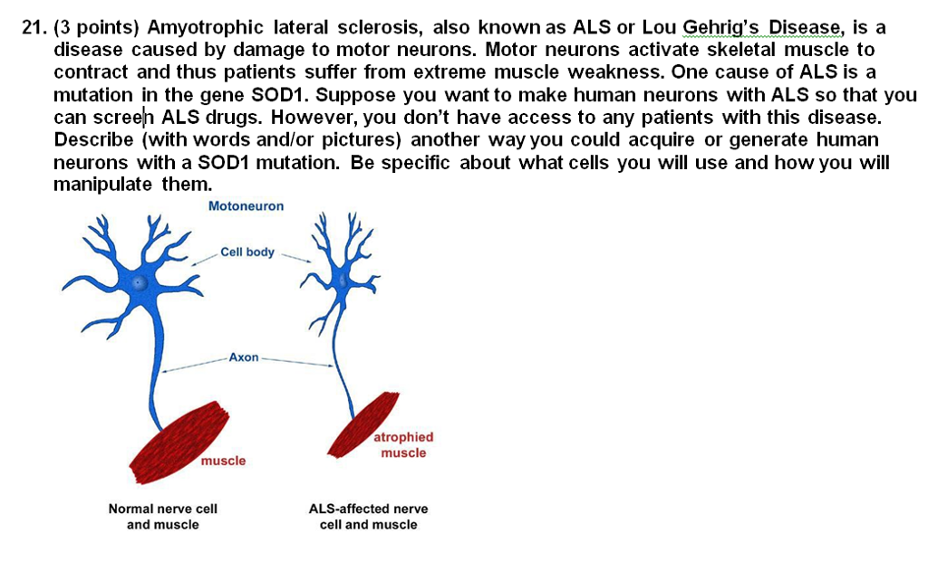 Solved 21. (3 points) Amyotrophic lateral sclerosis, also | Chegg.com