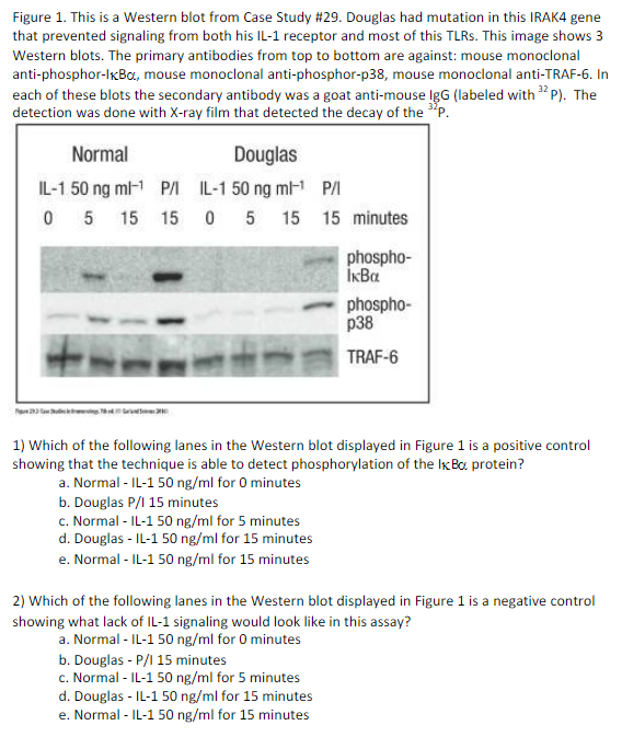 Solved Figure 1. This is a Western blot from Case Study #29. | Chegg.com
