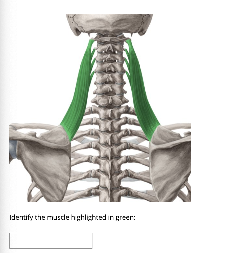 Solved Identify the muscle highlighted in green: | Chegg.com