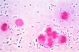 Solved B. A. Patient A has an infected wound. A sample of | Chegg.com