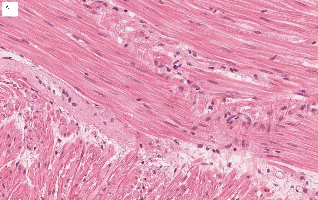 Solved Which picture represents Smooth Muscle and which is | Chegg.com