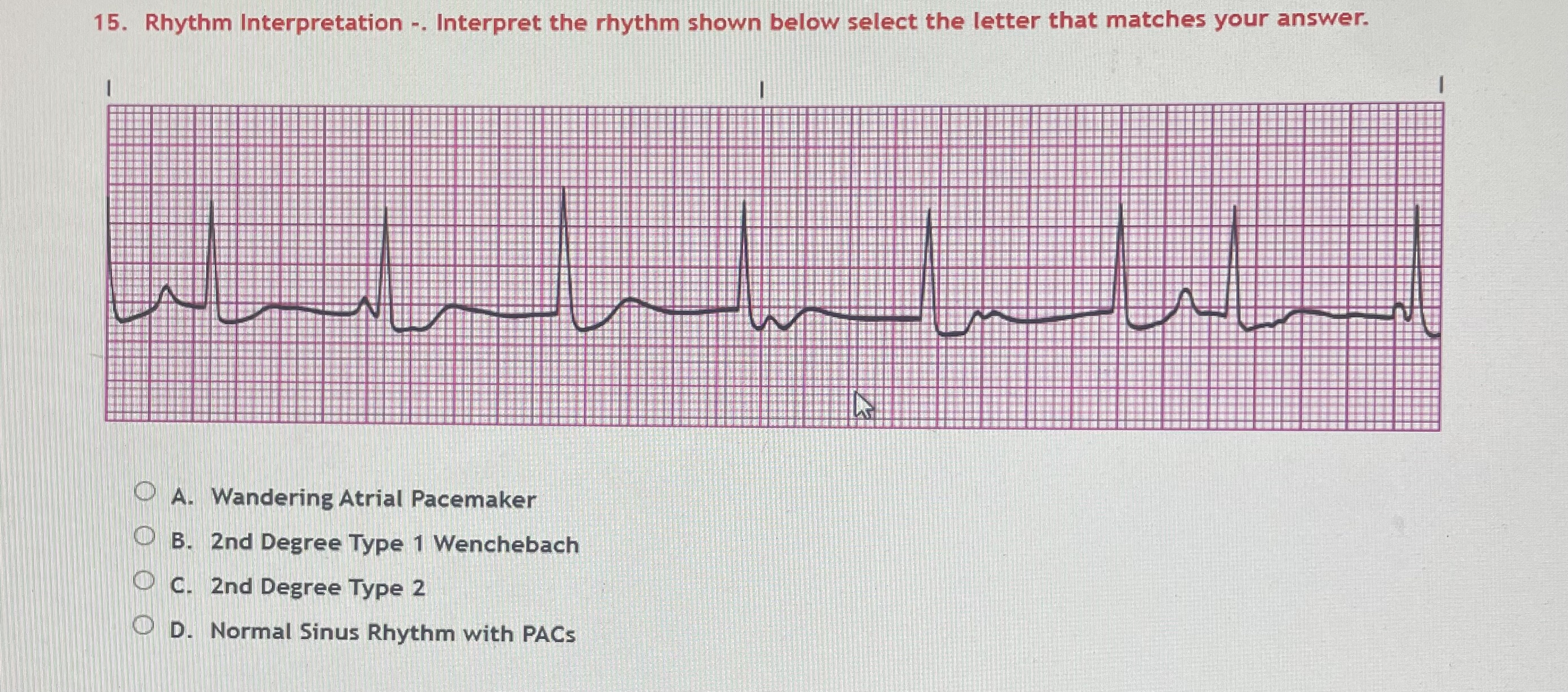 Solved 15. ﻿Rhythm Interpretation -. ﻿Interpret the rhythm | Chegg.com