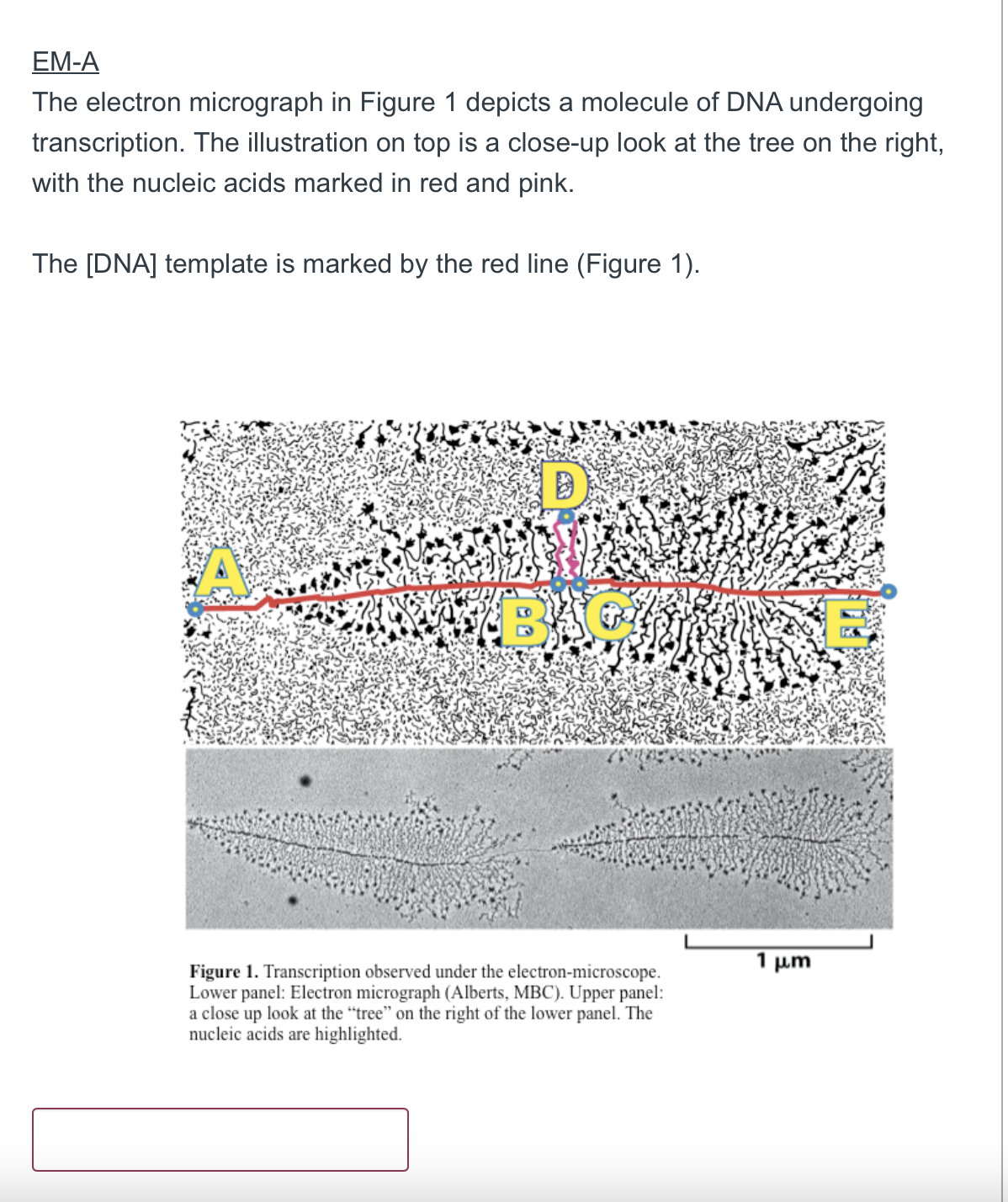 Solved EM-A The electron micrograph in Figure 1 depicts a | Chegg.com