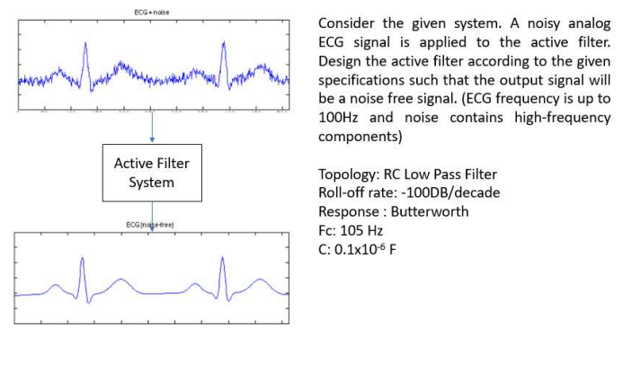 Solved Consider the given system. A noisy analog ECG signal | Chegg.com