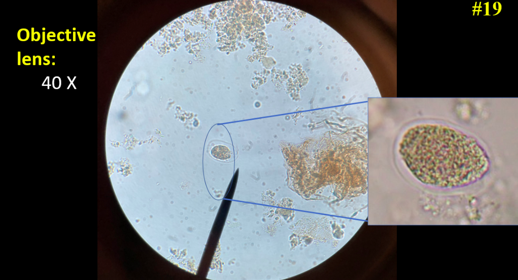 Solved #19 Objective lens: 40 X 1 Objective lens: 4 X | Chegg.com