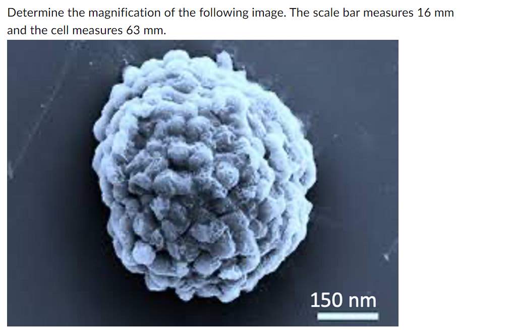 Solved Determine the magnification of the following image. | Chegg.com