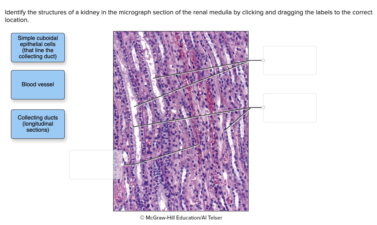 Solved Identify the structures of a kidney in the micrograph | Chegg.com