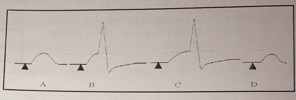 Solved For the following question - Clearly identify (by | Chegg.com