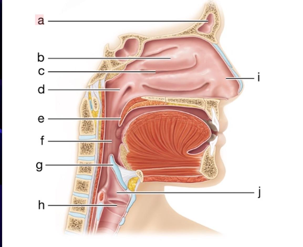 Solved Please Help and Label | Chegg.com