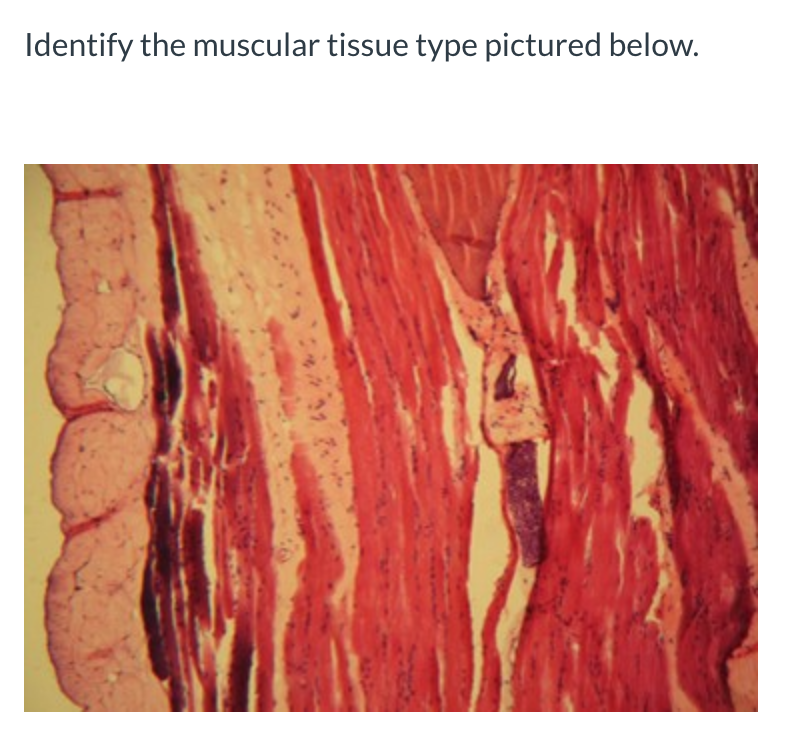 Solved Identify the connective tissue type pictured below. | Chegg.com Solved Identify the connective tissue type pictured below. | Chegg.com
