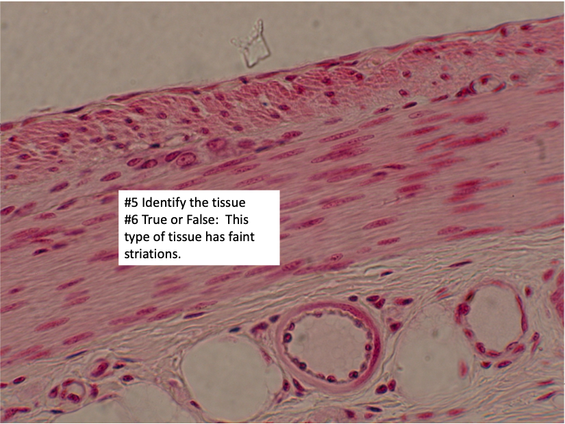 Solved #5 Identify the tissue #6 True or False: This type of | Chegg.com