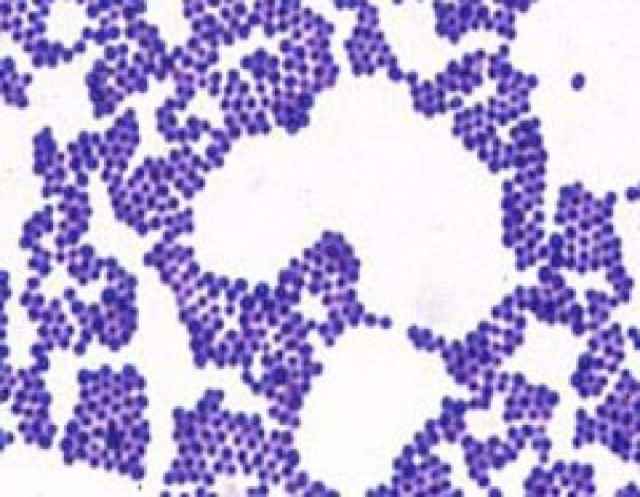 Mrsa Bacteria Gram Stain