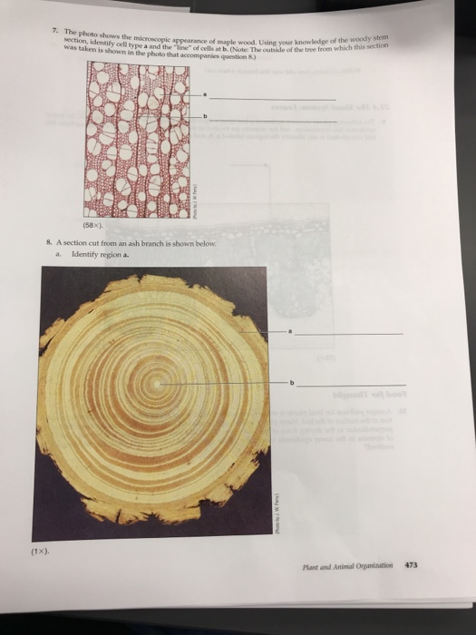 Solved 7. The photo shows the microscopic appearance of | Chegg.com