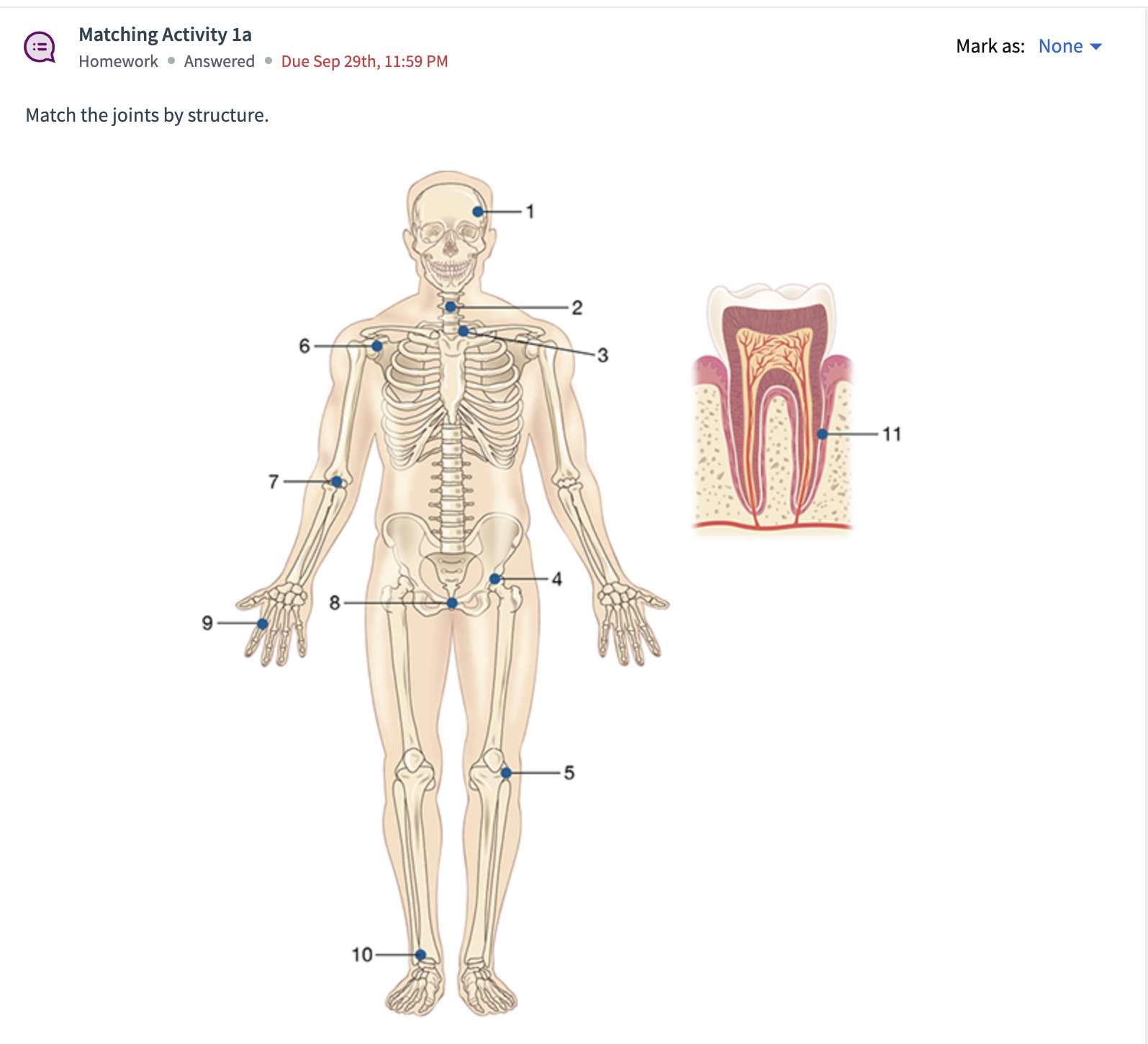 Solved Match the joints by structure. Please classify with | Chegg.com