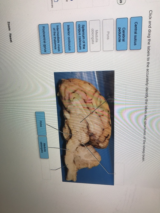 Solved Click and drag the labels to the accurately identify | Chegg.com