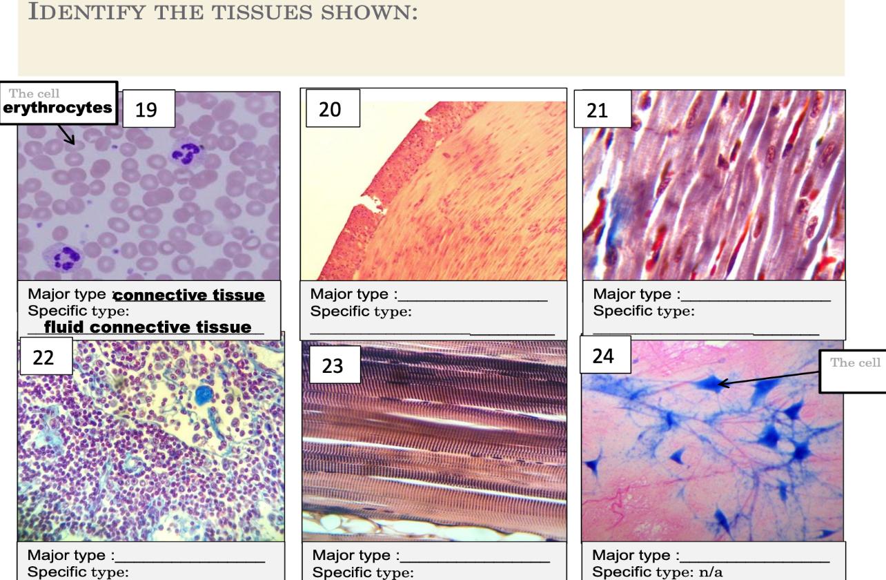 Solved IDENTIFY THE TISSUES SHOWN: The cell erythrocytes 19 | Chegg.com