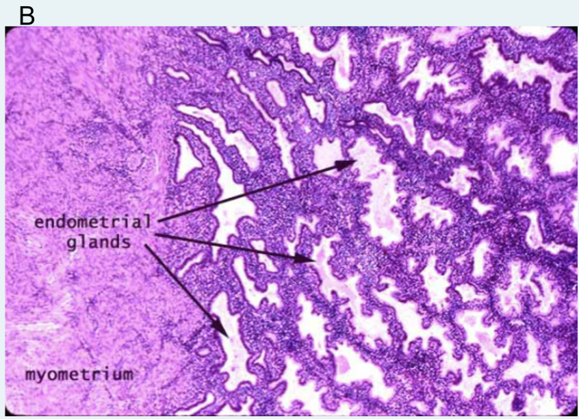 Solved The endometrial appearance in histology is very | Chegg.com