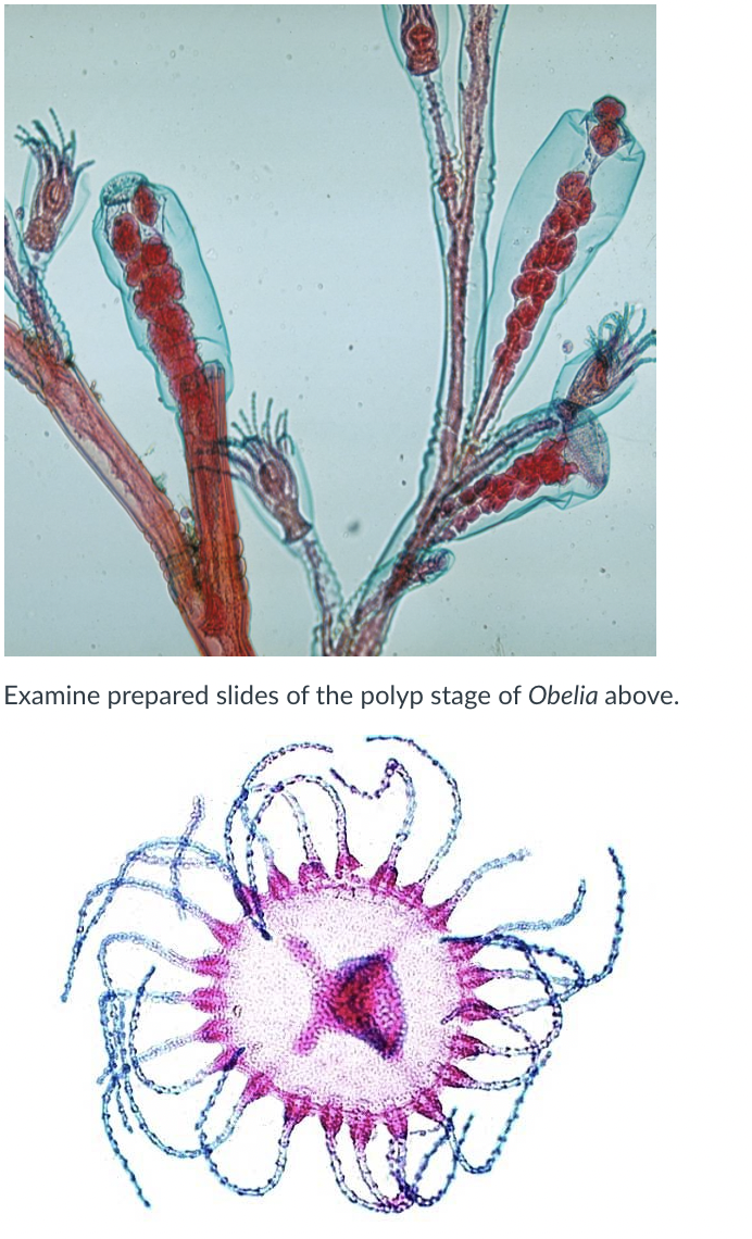 Obelia Slide Labeled