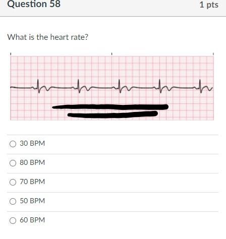 Solved Question 58 What is the heart rate? 1 pts بل للسلسل O | Chegg.com