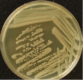 Solved Streak Plate Assessment Assignment Draw the pattern | Chegg.com