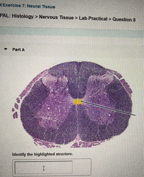 Solved Exercise 7: Neural Tissue PAL: Histology > Nervous | Chegg.com