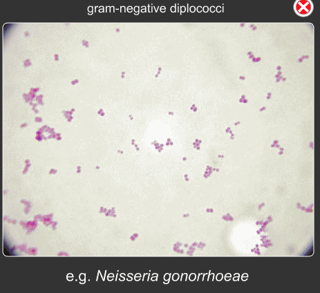 Neisseria Gonorrhoeae Gram Stain