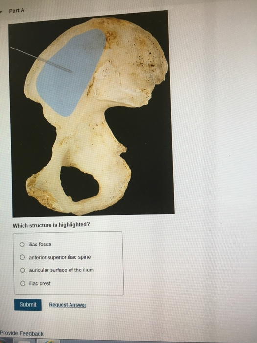 Solved Part A Which structure is highlighted? O iliac fossa | Chegg.com