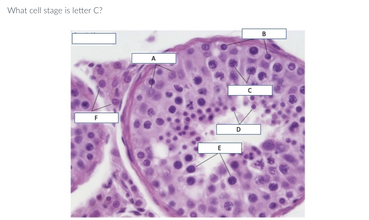 What cell stage is letter C? | Chegg.com