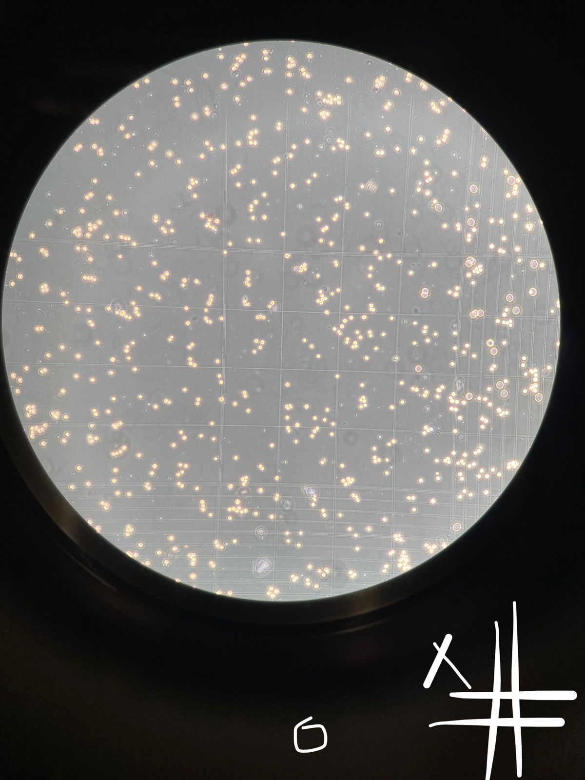 Solved Counting trypsinized cells (with 2.5% 0% (control) | Chegg.com