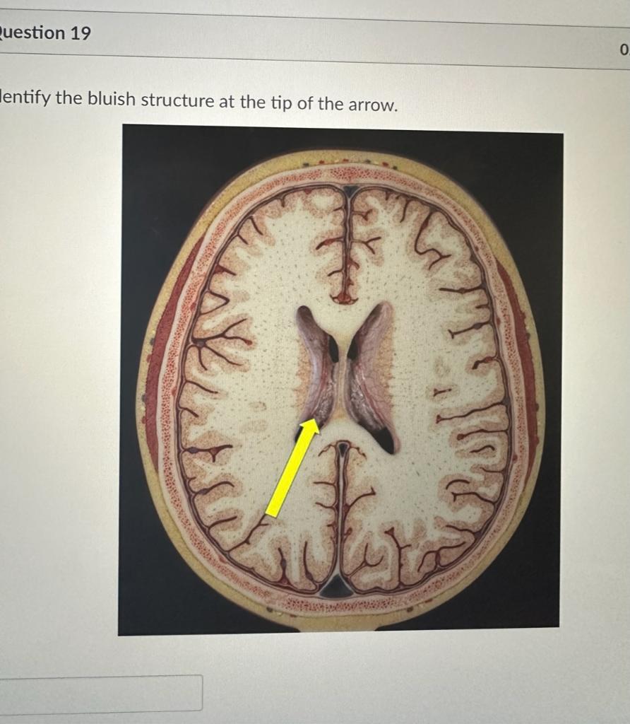 entify the bluish structure at the tip of the arrow. | Chegg.com