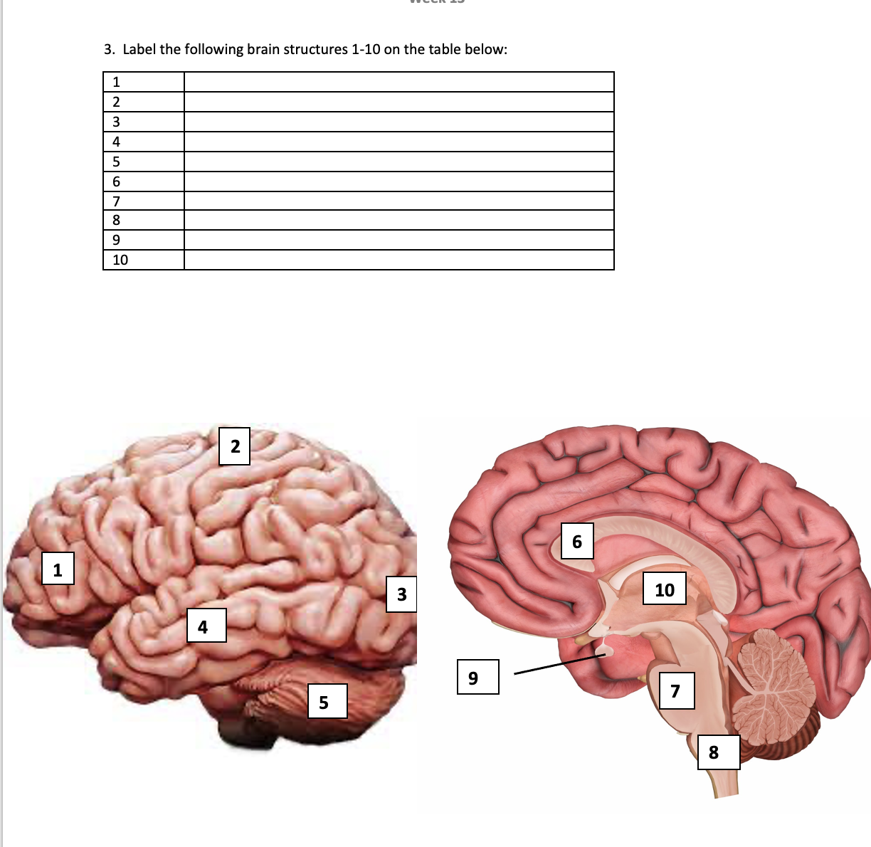 Solved Label the following brain structures 1-10 ﻿on the | Chegg.com