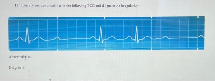 Solved Identify any abnormalities in the following ECG and | Chegg.com