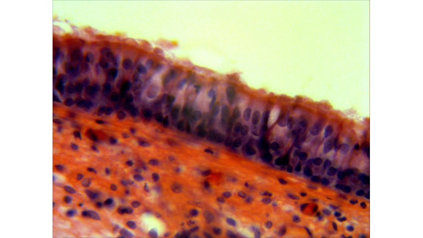 Solved On this high power microscope picture of | Chegg.com