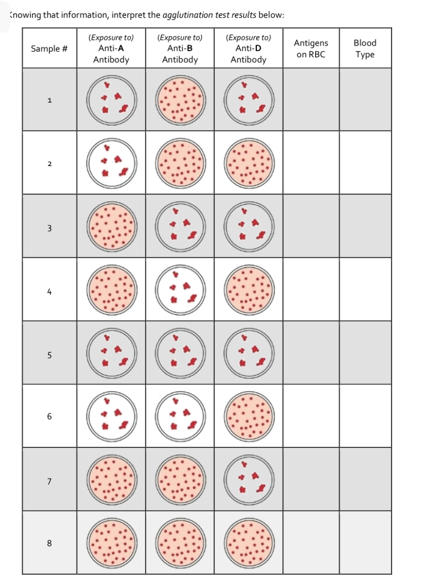 Solved knowing that information, interpret the agglutination | Chegg.com