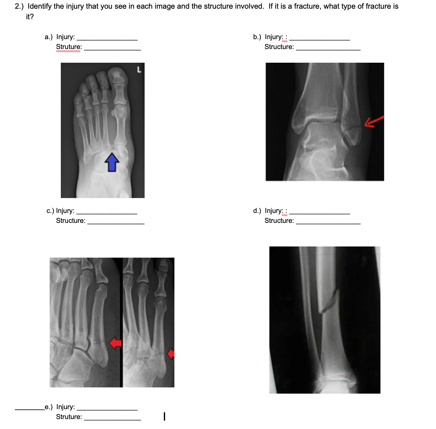 Solved 2.) Identify the injury that you see in each image | Chegg.com