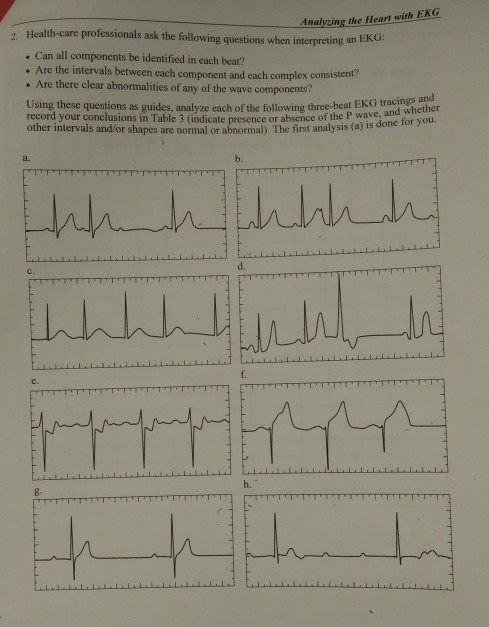 Solved Analyzing the Heart with EKG Health-care | Chegg.com