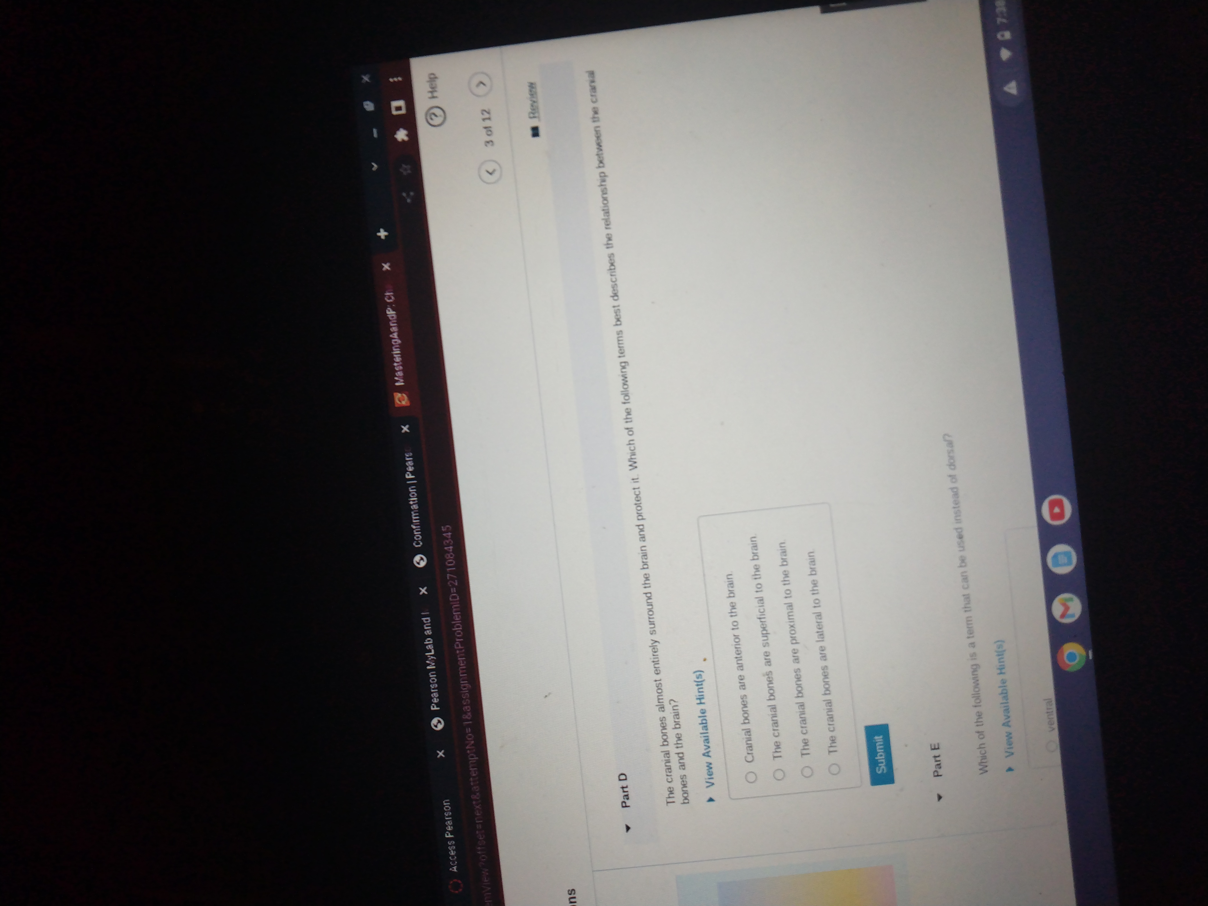 Solved Part Dbones and the brain?View Available | Chegg.com