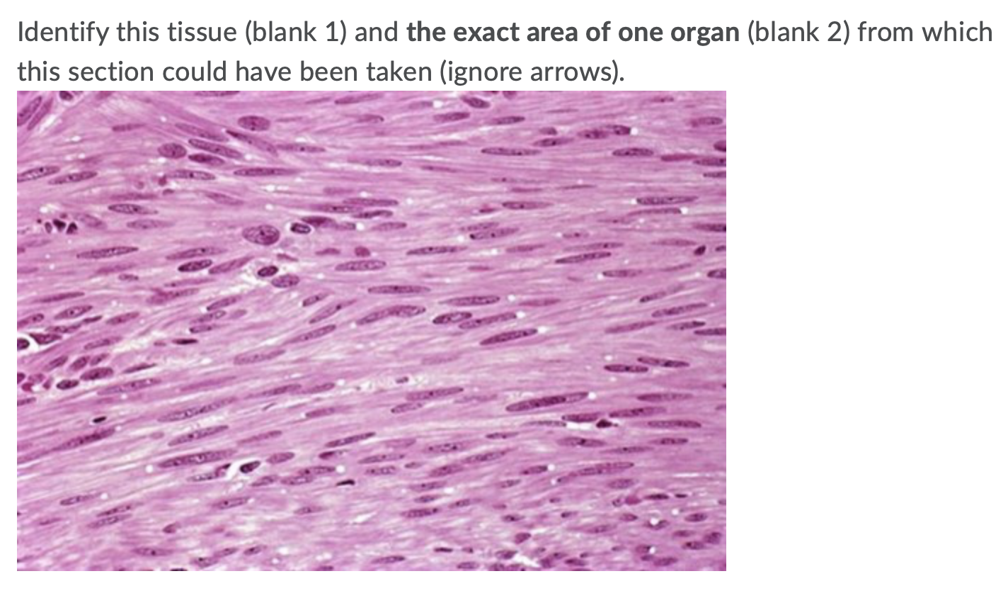 Solved Identify this tissue (blank 1) and the exact area of | Chegg.com