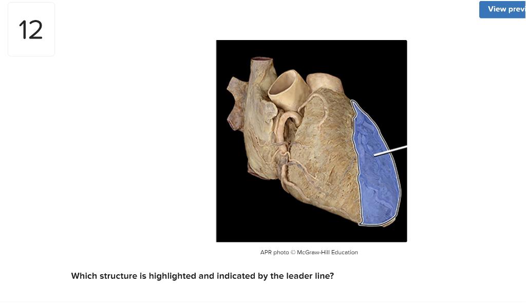 Solved 16 APR photo McGraw-Hill Education Which structure is | Chegg.com