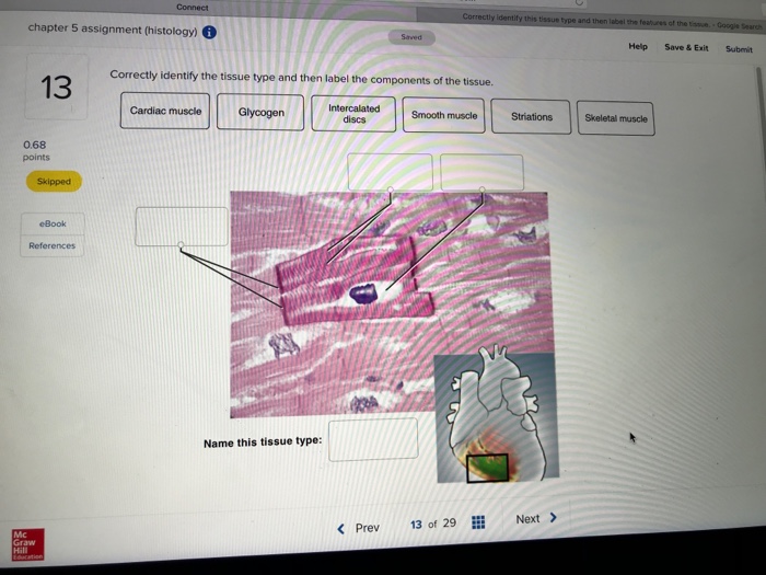 Solved: Assignment (histology) Saved Correctly Identify Th... | Chegg.com Solved: Assignment (histology) Saved Correctly Identify Th... | Chegg.com
