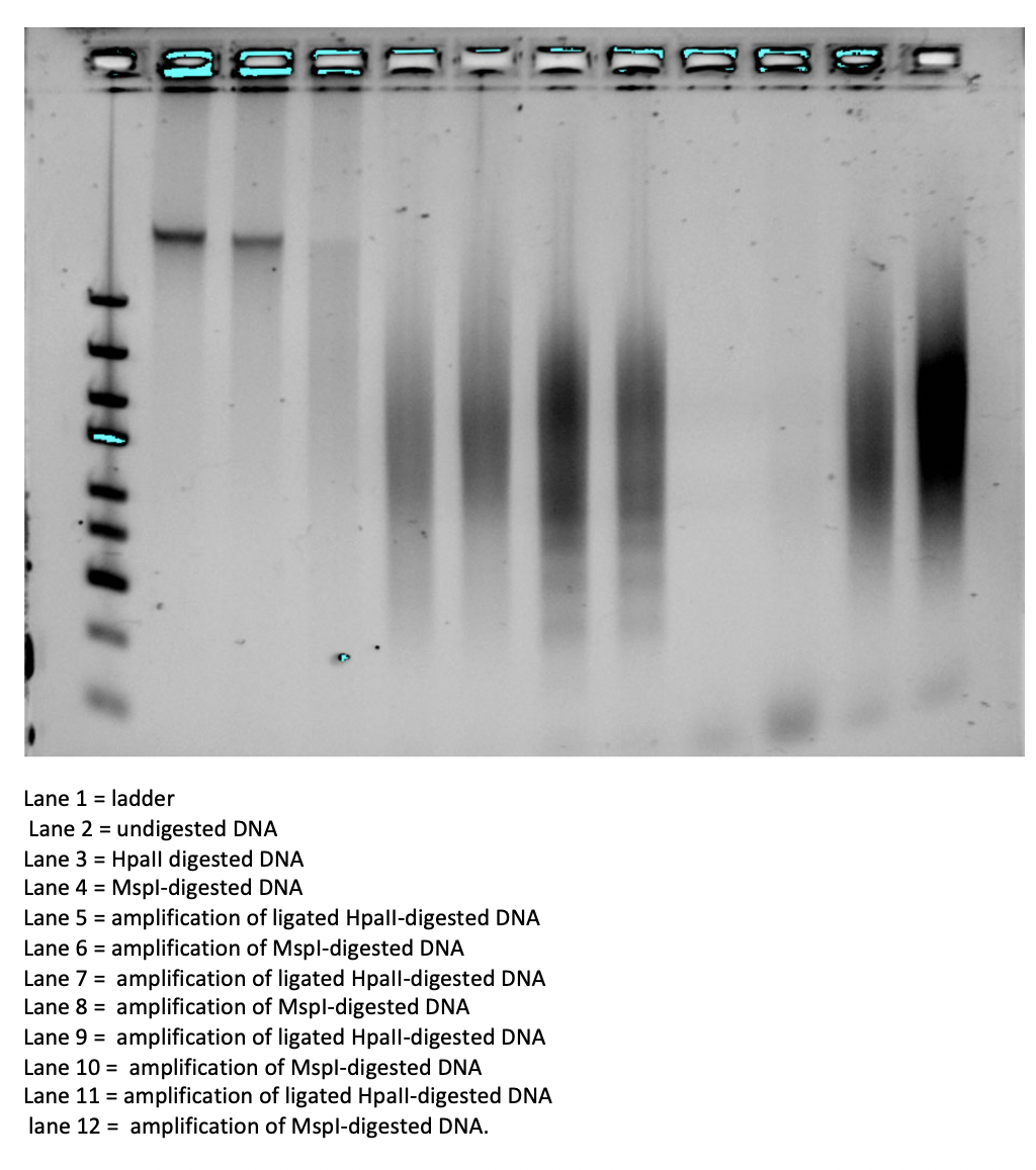 Solved (1 5 Lane 1 = ladder Lane 2 = undigested DNA Lane 3 = | Chegg.com