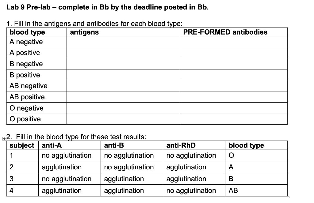 Solved Lab 9 Pre-lab - complete in Bb by the deadline posted | Chegg.com