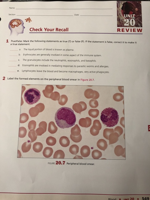 Solved UNIT 20 REVIEW Section Check Your Recall 1 | Chegg.com