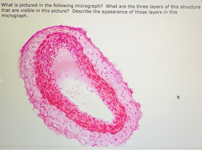 Solved What is pictured in the following micrograph? What | Chegg.com